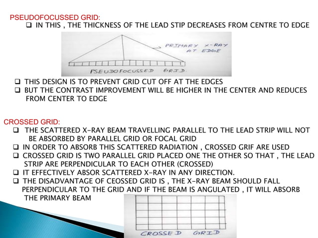 X-RAY GRID BUCKY | PPTX | Chemistry | Science