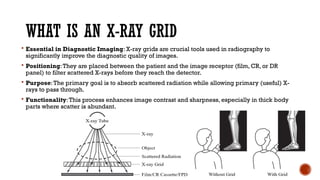 X-ray_Grids.pptx how grid is effective to reduce scattered radiation ...