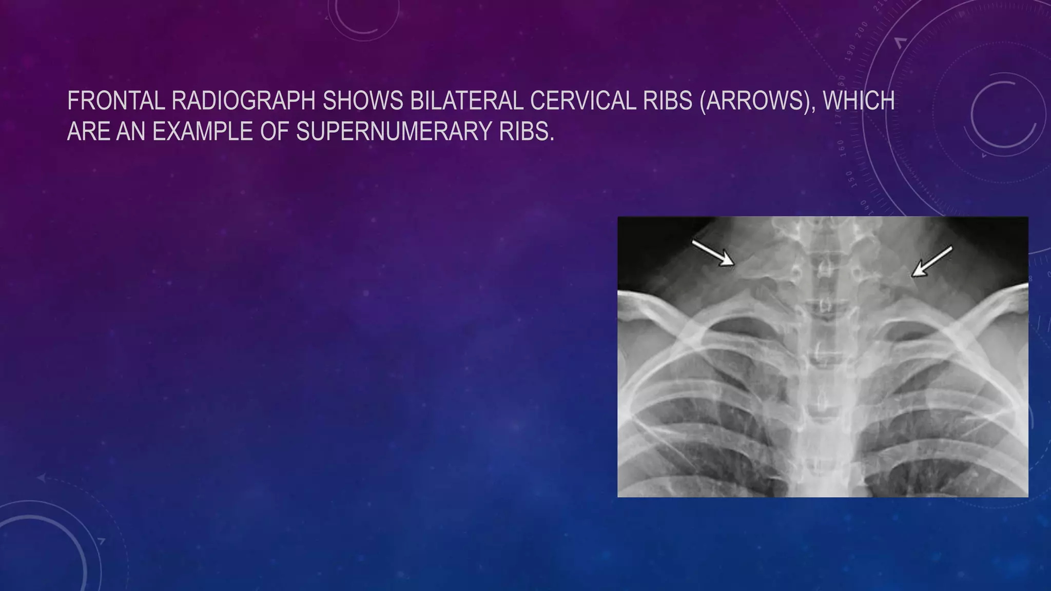 X-ray images of lung diseases (pneumonia, tuberculosis, and tumors)..pptx