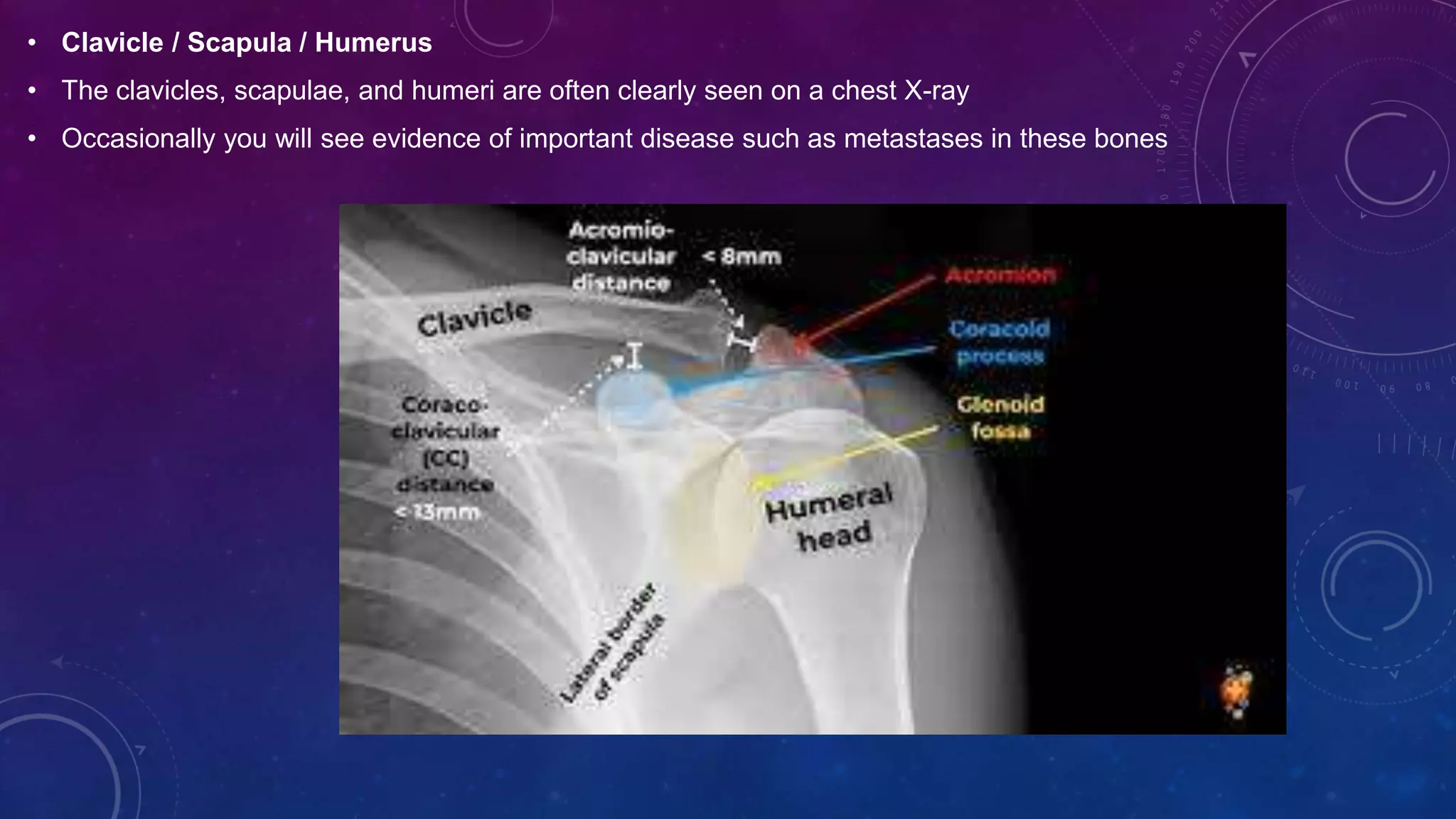 X-ray images of lung diseases (pneumonia, tuberculosis, and tumors)..pptx