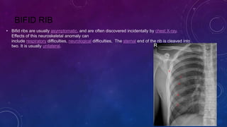 X-ray images of lung diseases (pneumonia, tuberculosis, and tumors)..pptx