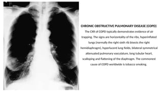 X-Ray Imaging Technique and Interpretation for Physiotherapists.pptx