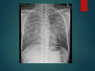 X Rays and medical instruments.pdf for exam | PPTX