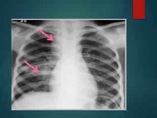 X Rays and medical instruments.pdf for exam | PPTX