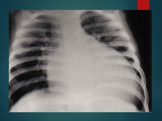 X Rays and medical instruments.pdf for exam | PPTX
