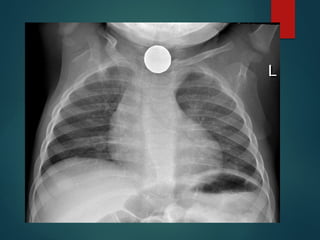 X Rays and medical instruments.pdf for exam | PPTX