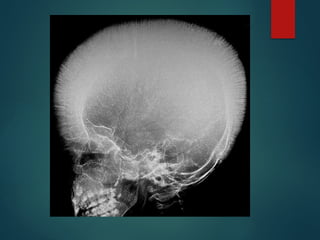 X Rays and medical instruments.pdf for exam | PPTX