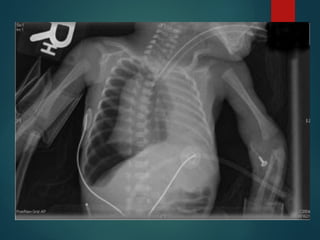 X Rays and medical instruments.pdf for exam | PPTX