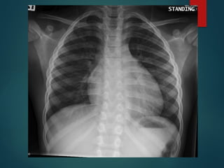 X Rays and medical instruments.pdf for exam | PPTX