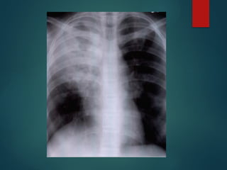 X Rays and medical instruments.pdf for exam | PPTX