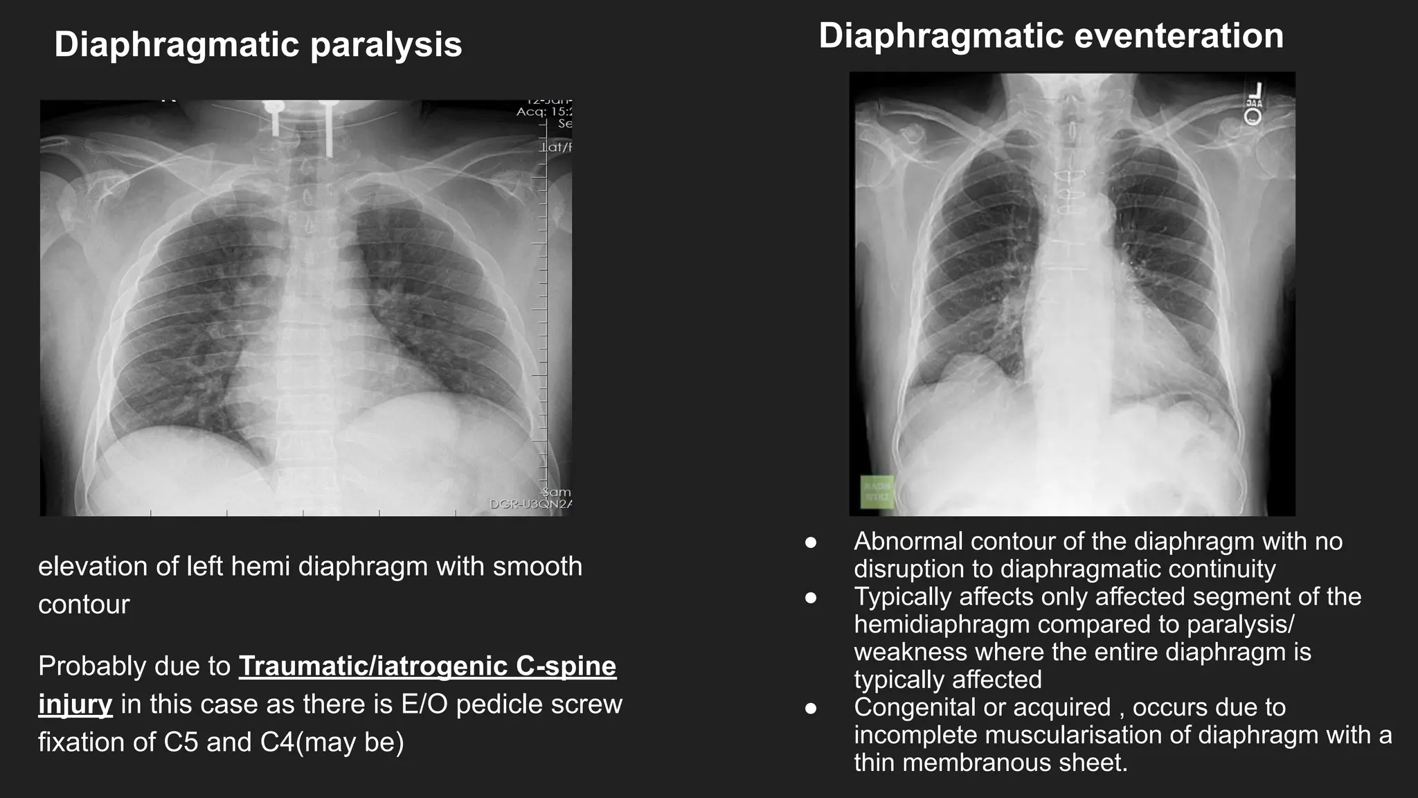 10 most interesting X-ray cases (Jan 2024 ) | PPT