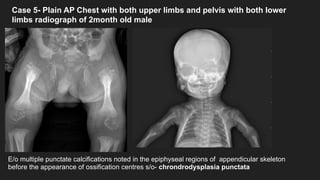 10 most interesting X-ray cases (Jan 2024 ) | PDF