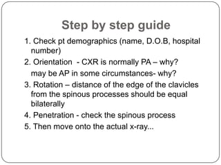 X-ray interpretation | PPTX