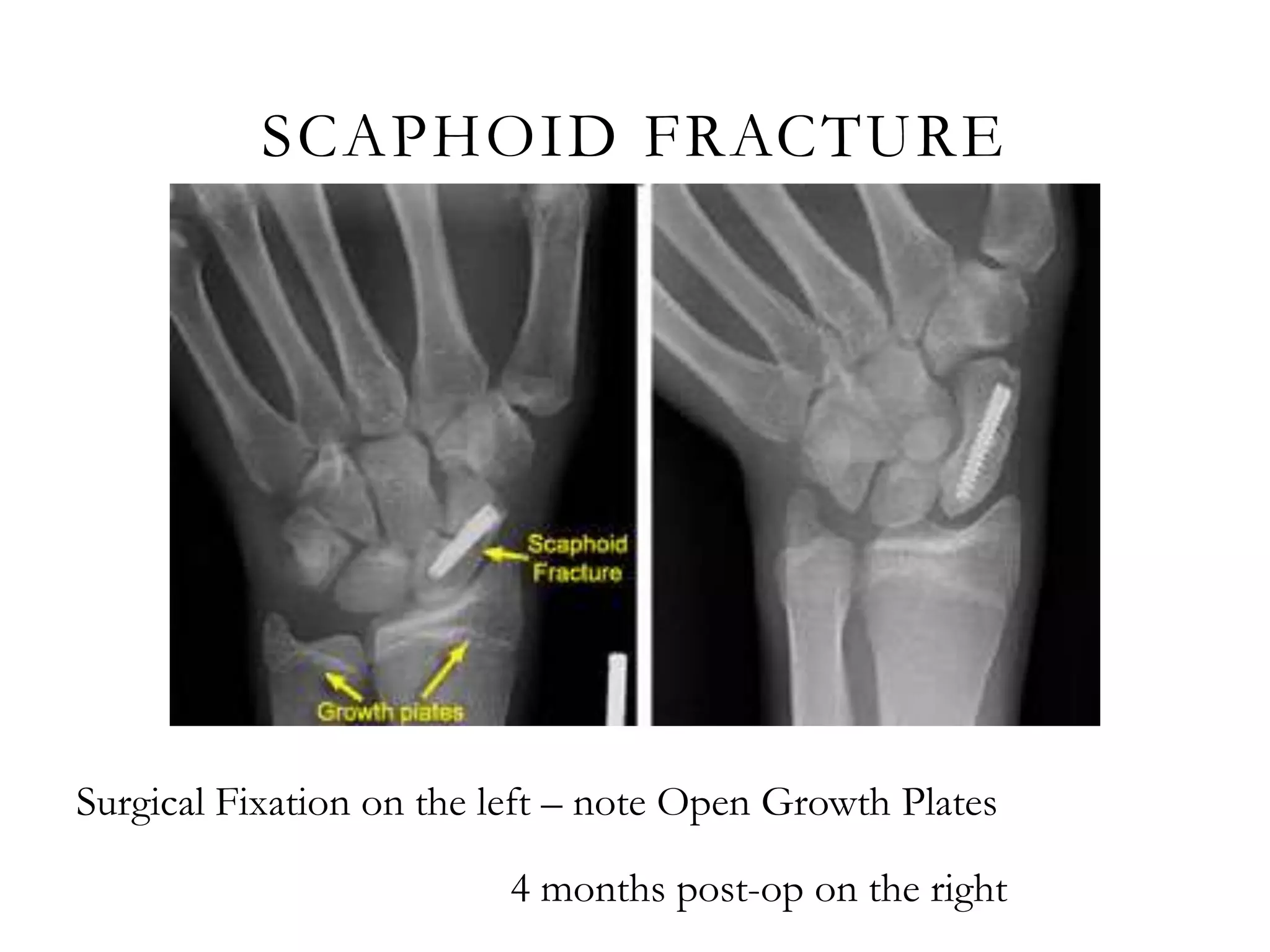 X ray interpretation maot | PPTX