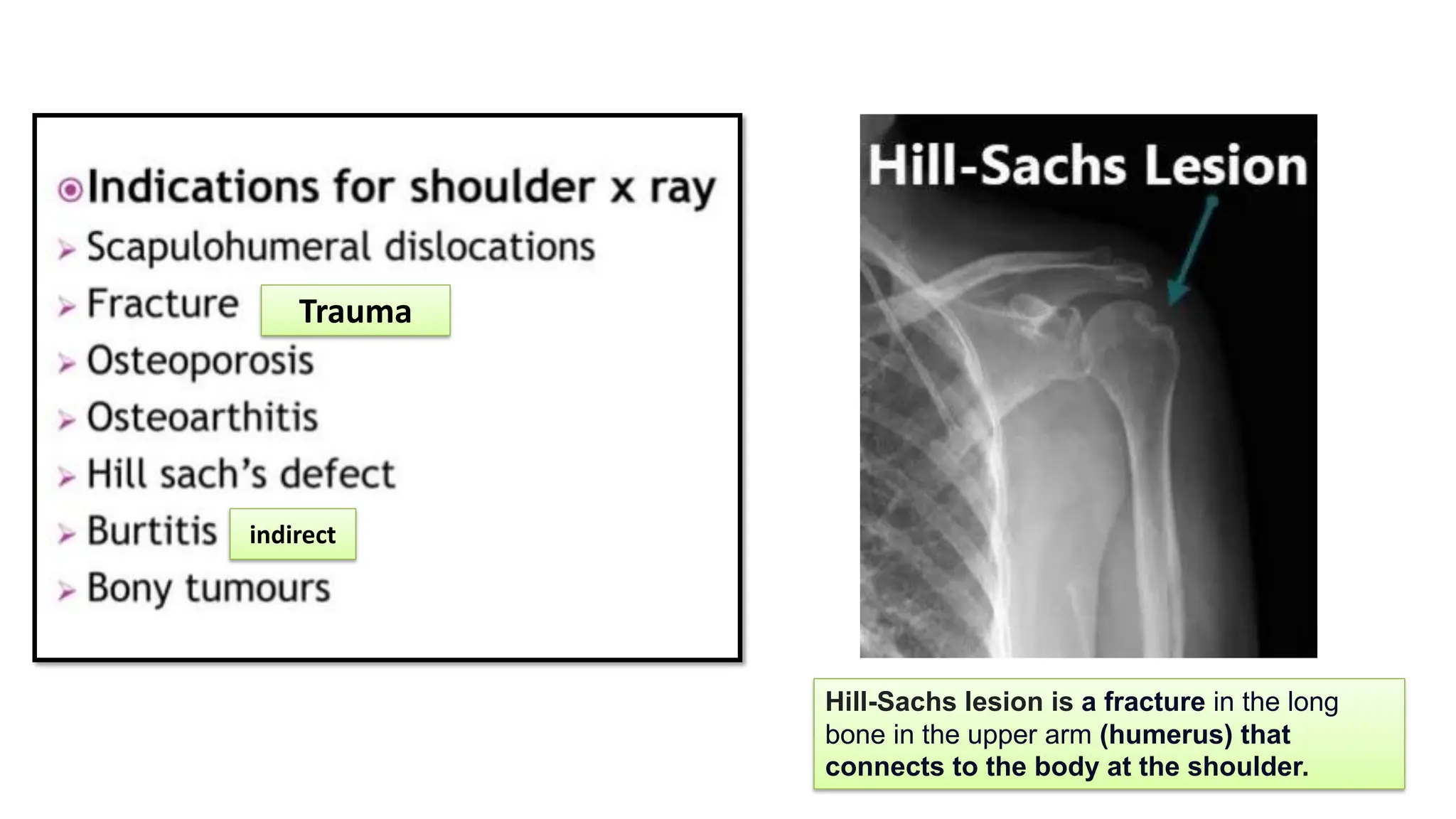 X-ray Joints imaging positions by dr. Eman Hamed | PDF