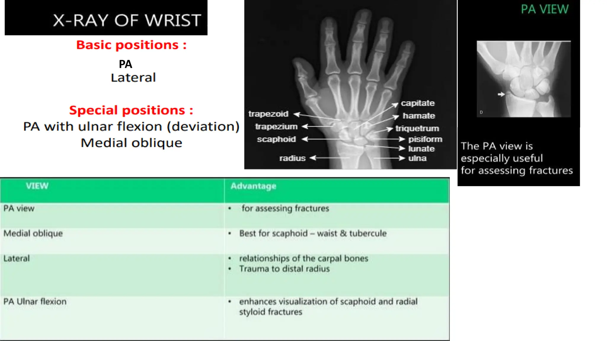 X-ray Joints imaging positions by dr. Eman Hamed | PDF