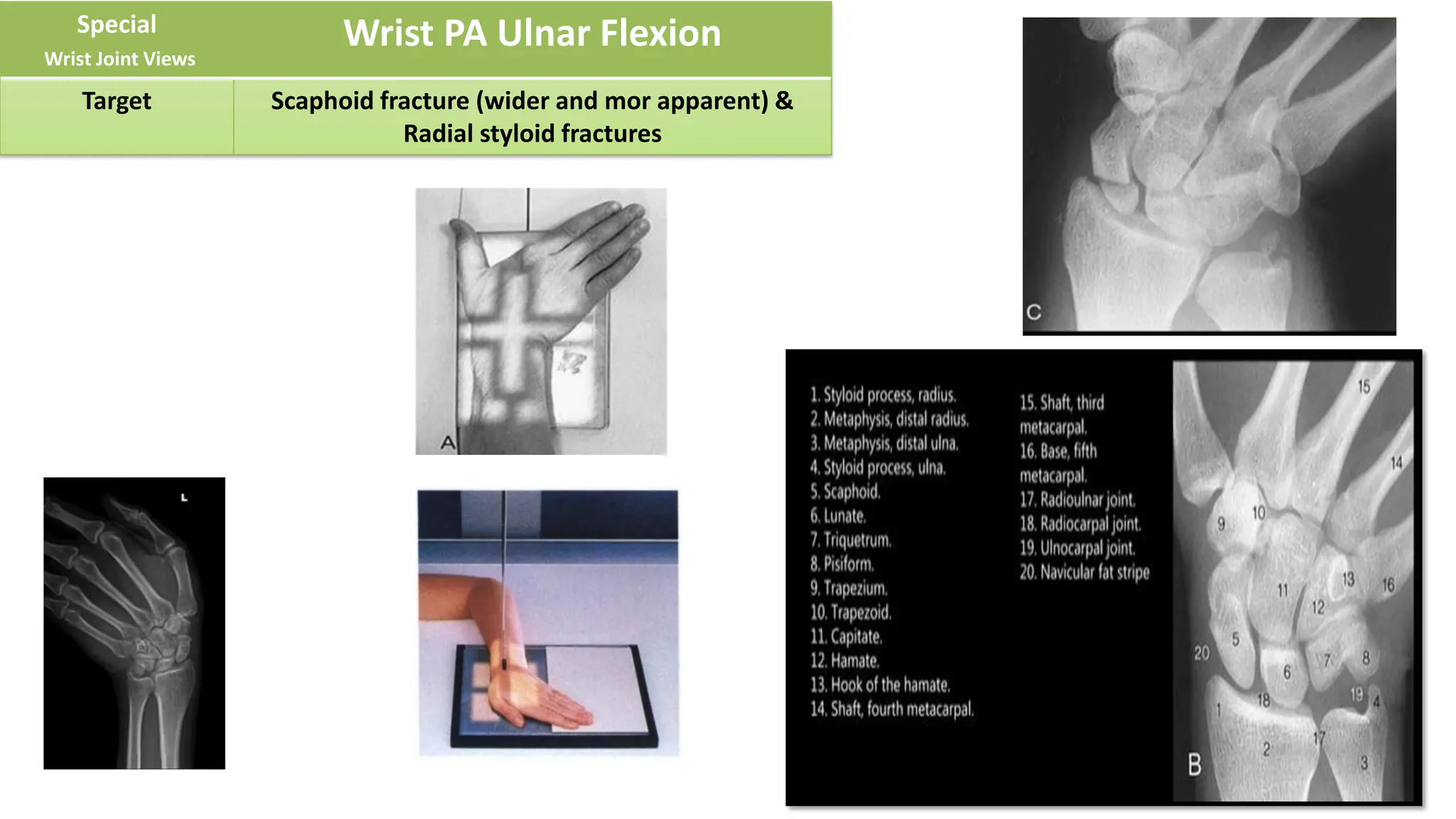 X-ray Joints imaging positions by dr. Eman Hamed | PDF