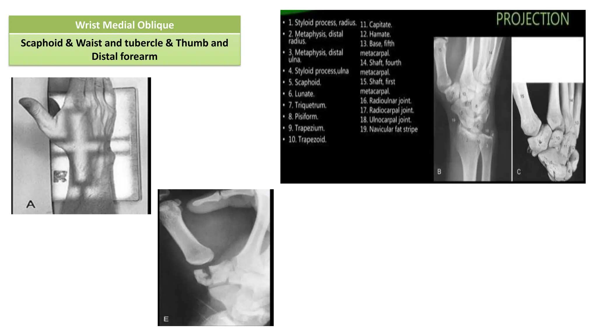 X-ray Joints imaging positions by dr. Eman Hamed | PDF