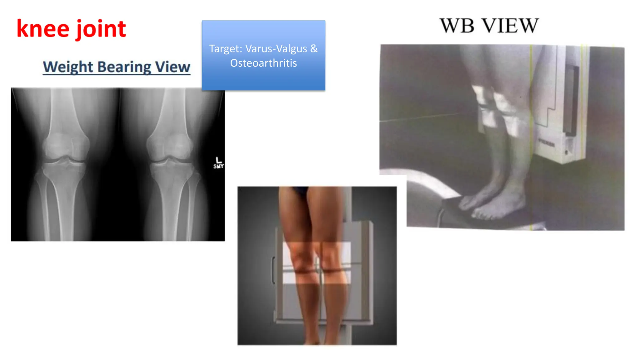 X-ray Joints imaging positions by dr. Eman Hamed | PPT