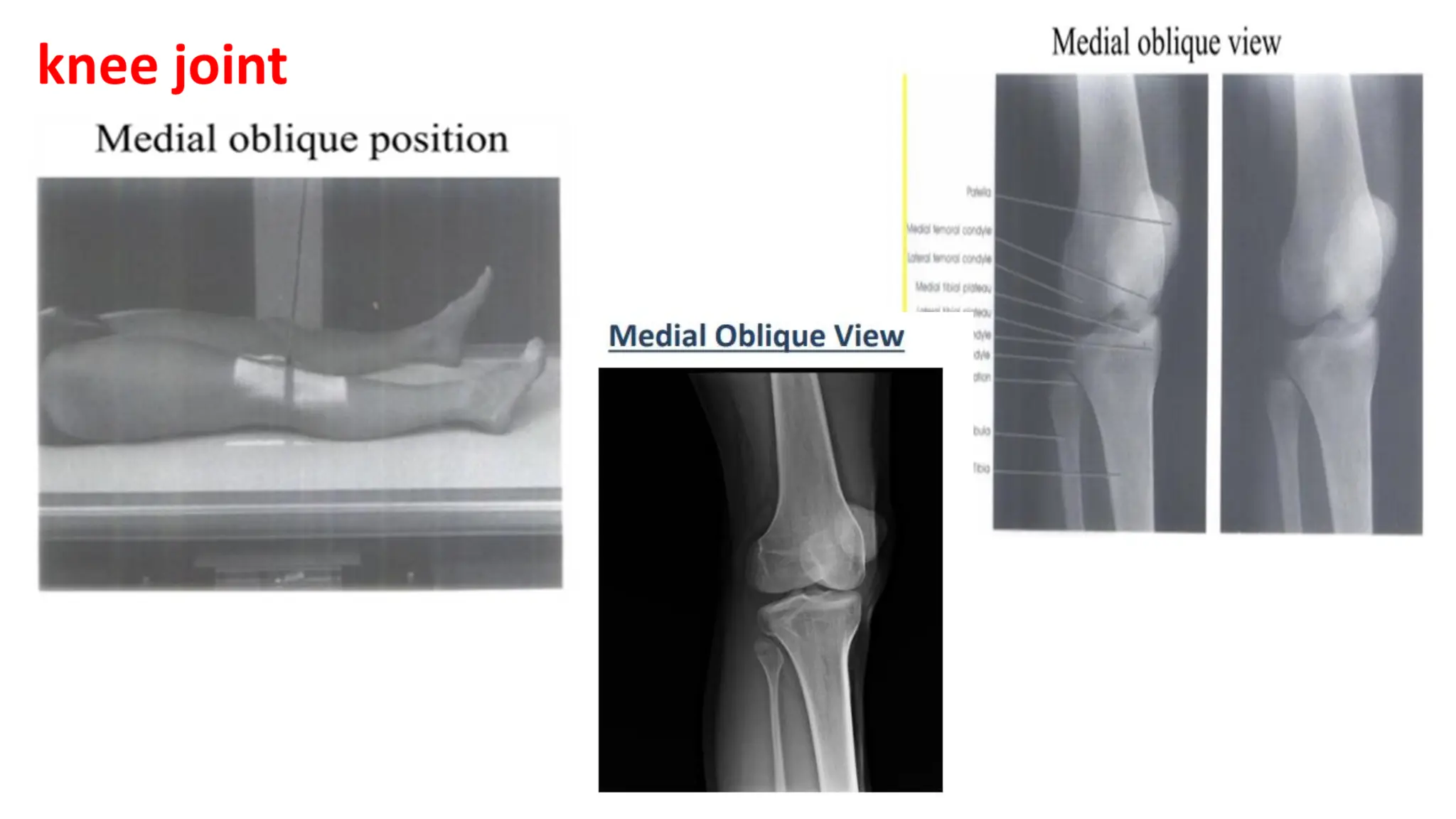 X-ray Joints imaging positions by dr. Eman Hamed | PDF