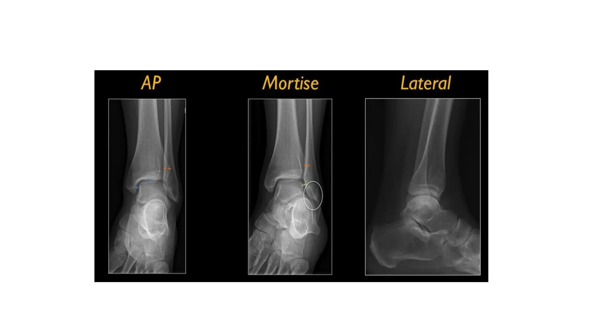 X-ray Joints imaging positions by dr. Eman Hamed | PDF