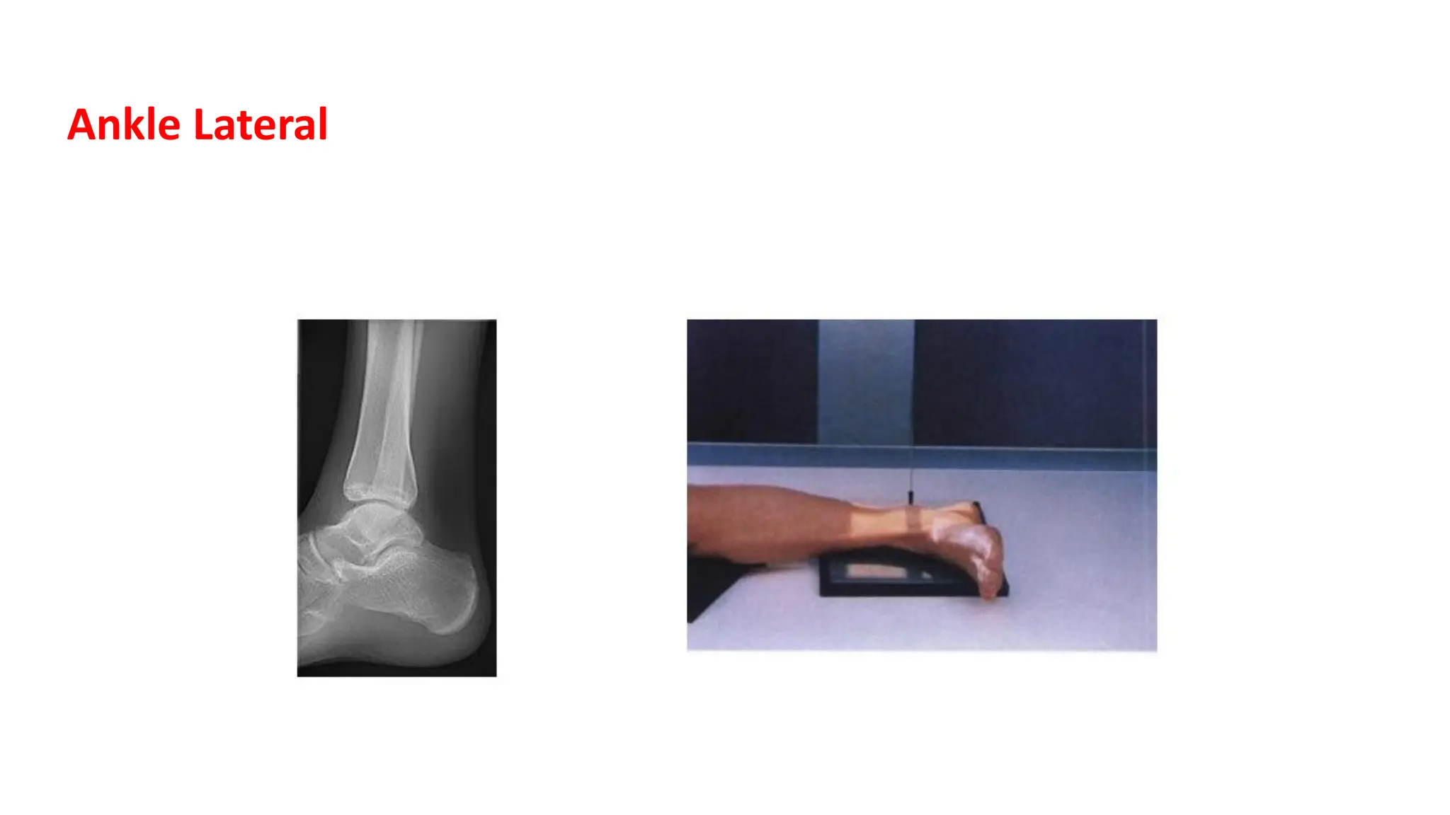 X-ray Joints imaging positions by dr. Eman Hamed | PPT