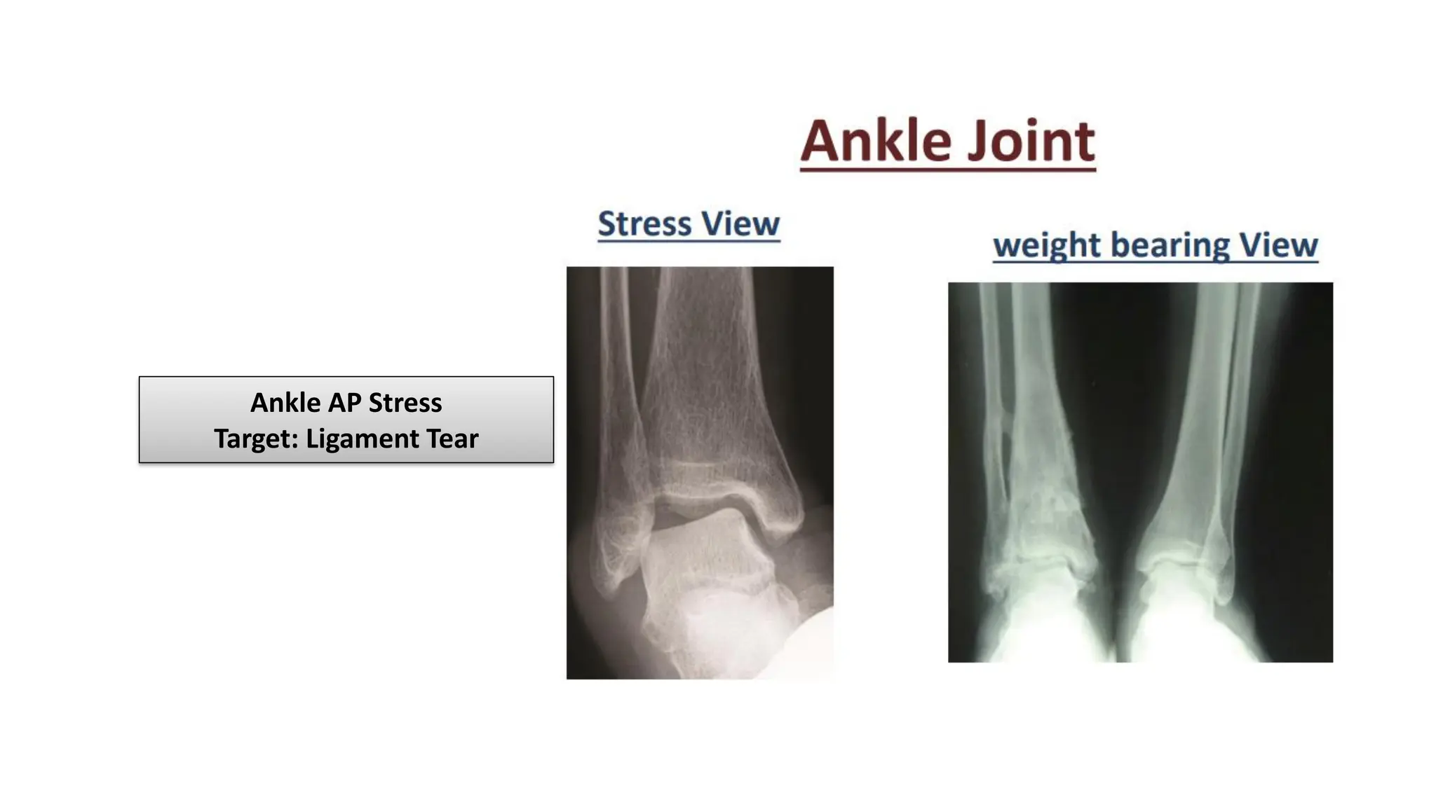 X-ray Joints imaging positions by dr. Eman Hamed | PDF