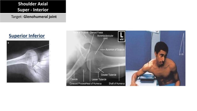 X-ray Joints imaging positions by dr. Eman Hamed | PDF