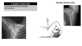 X-ray Joints imaging positions by dr. Eman Hamed | PDF