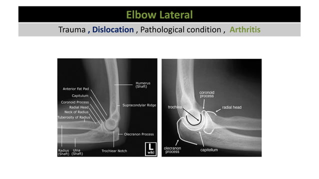 X-ray Joints imaging positions by dr. Eman Hamed | PDF