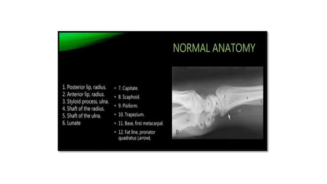 X-ray Joints imaging positions by dr. Eman Hamed | PDF