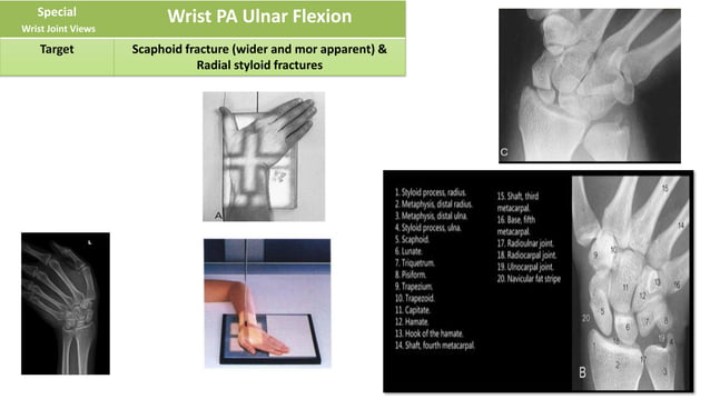 X-ray Joints imaging positions by dr. Eman Hamed | PDF