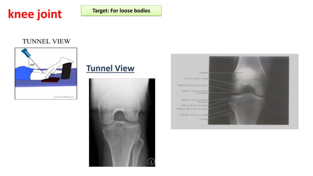 X-ray Joints imaging positions by dr. Eman Hamed | PDF