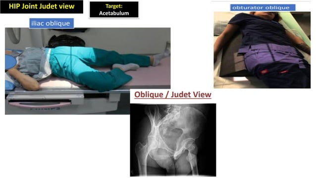 X-ray Joints imaging positions by dr. Eman Hamed | PDF