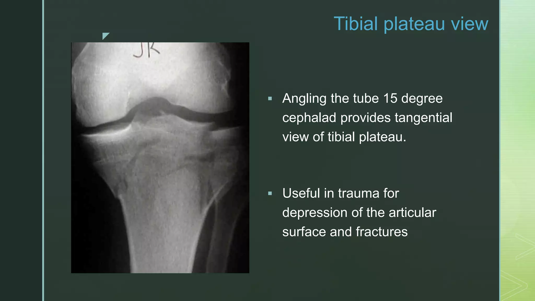 X ray knee joint | PPTX