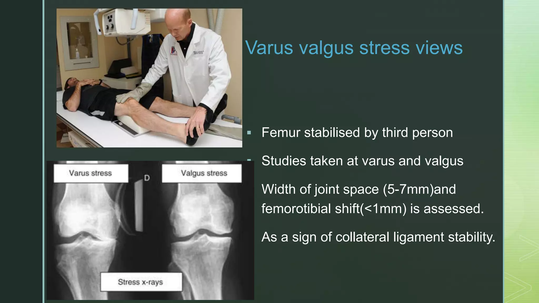 X ray knee joint | PPTX