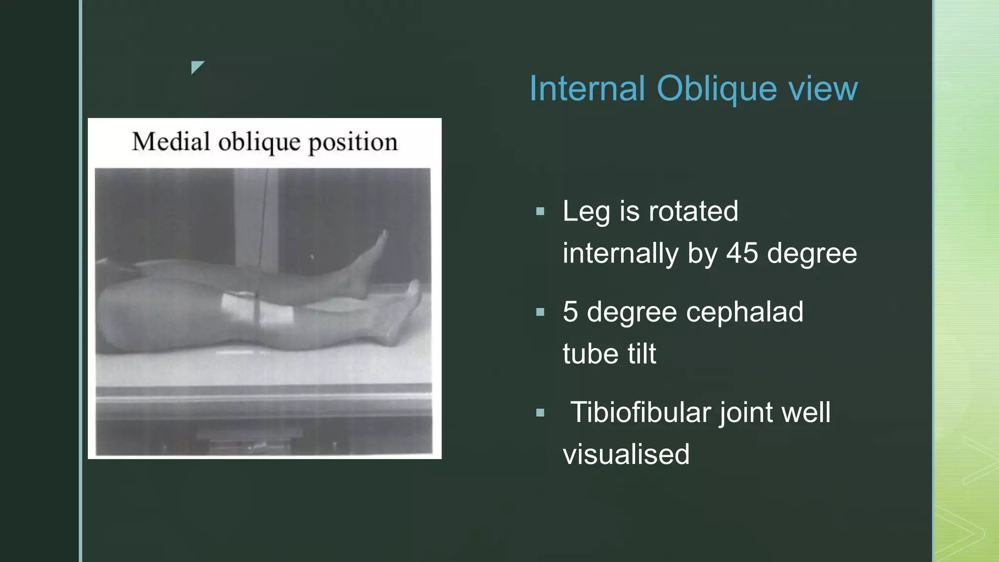 X ray knee joint | PPTX