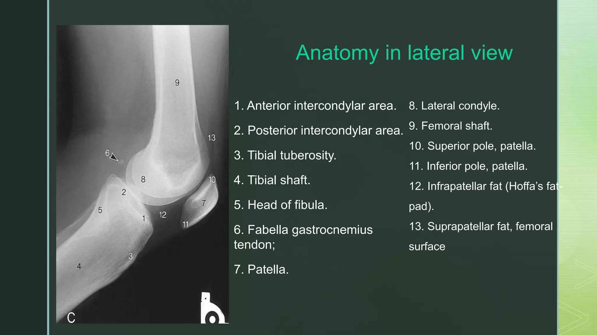 X ray knee joint | PPTX