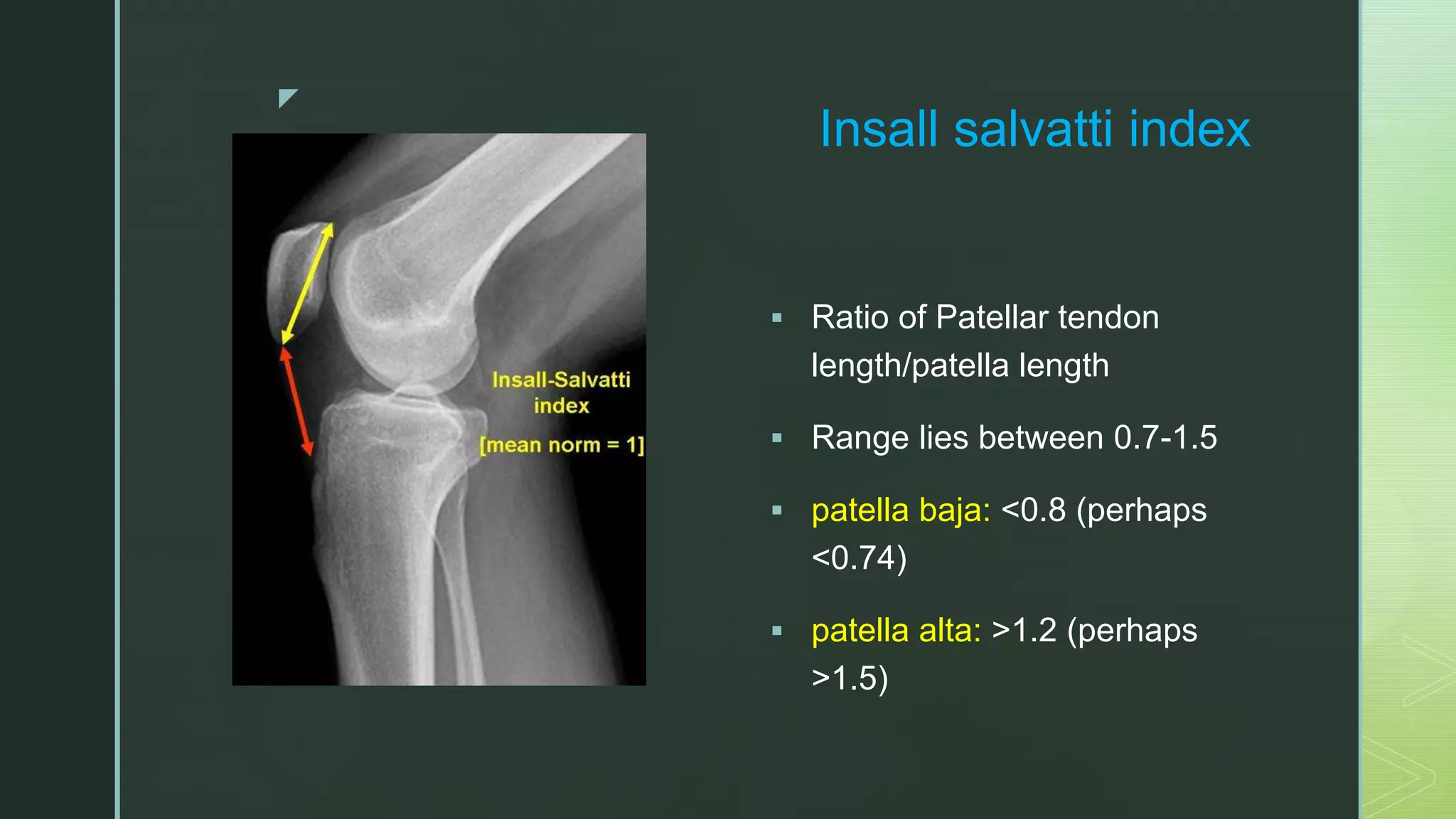 X ray knee joint | PPTX