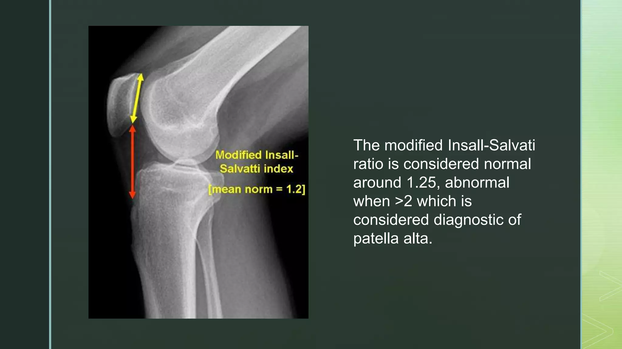X ray knee joint | PPTX