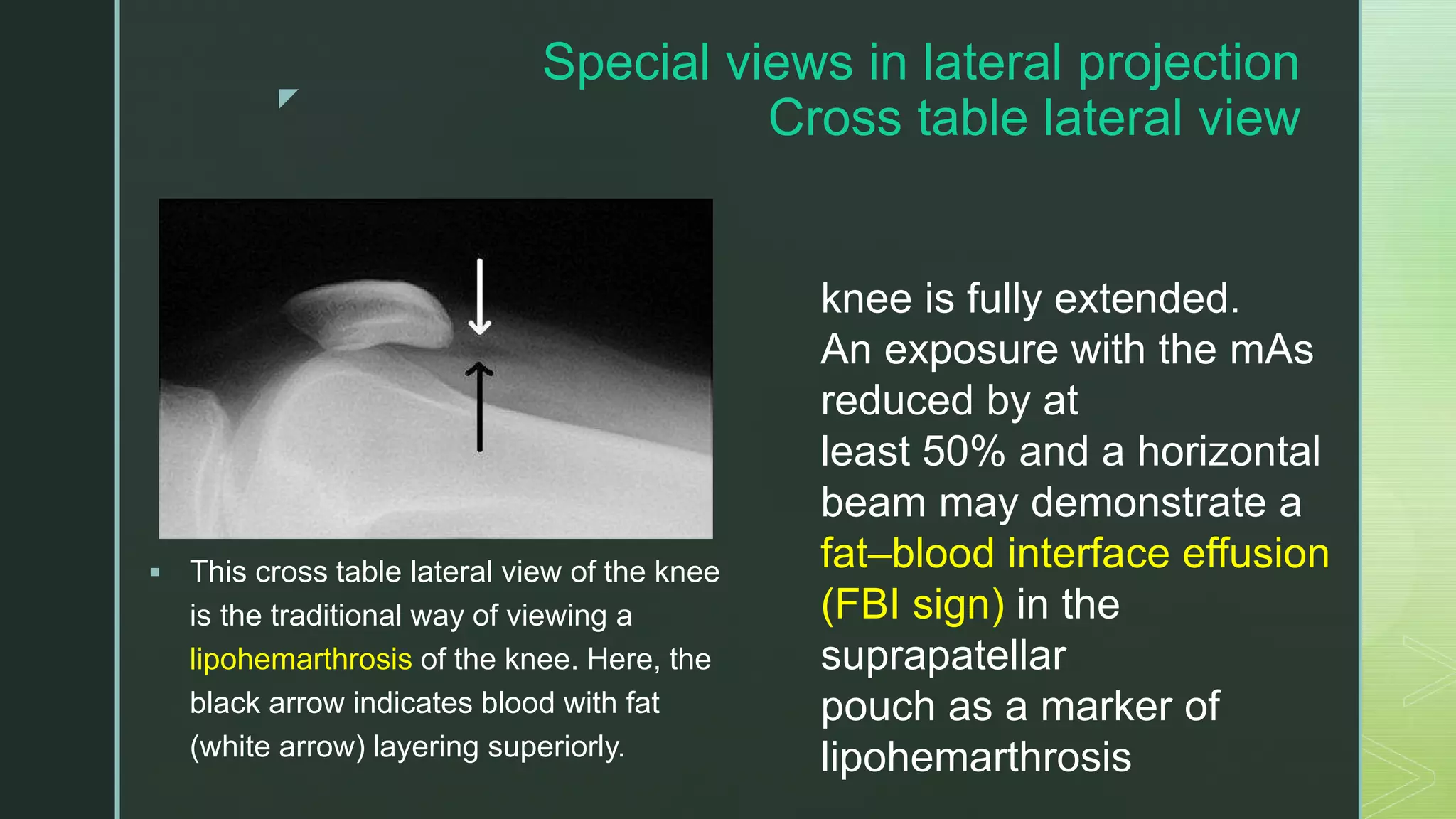X ray knee joint | PPTX