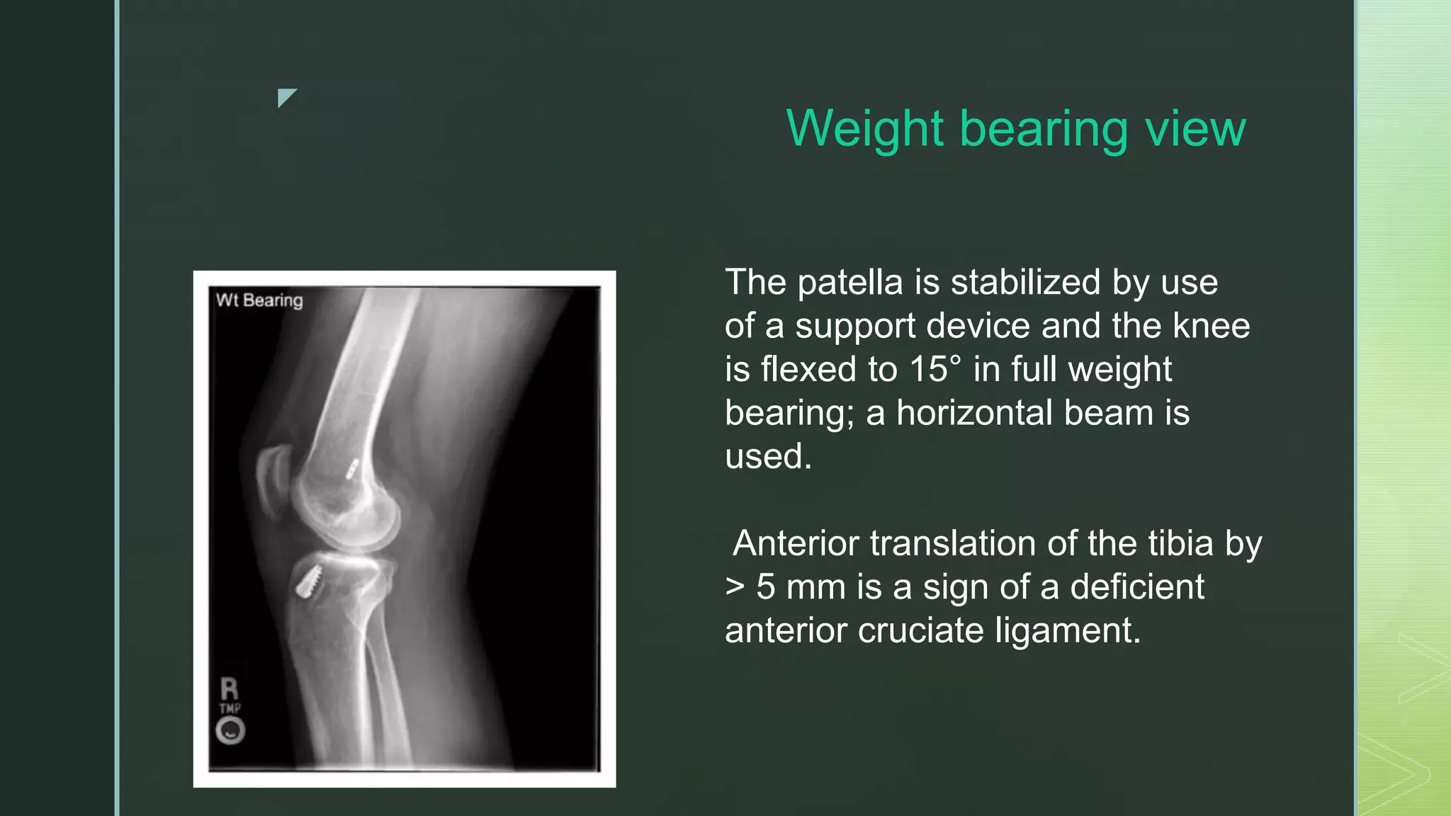 X ray knee joint | PPTX