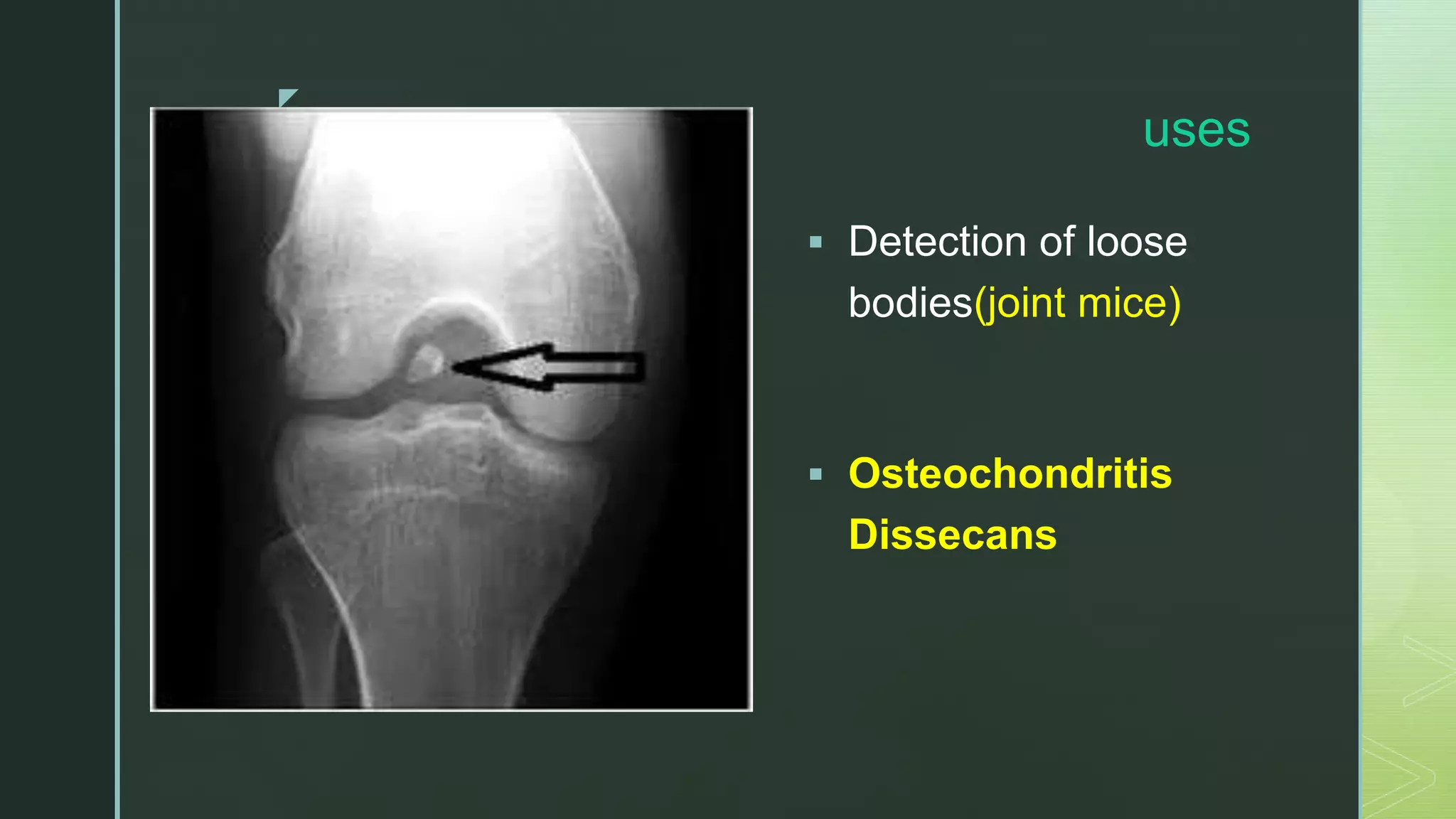 X ray knee joint | PPTX