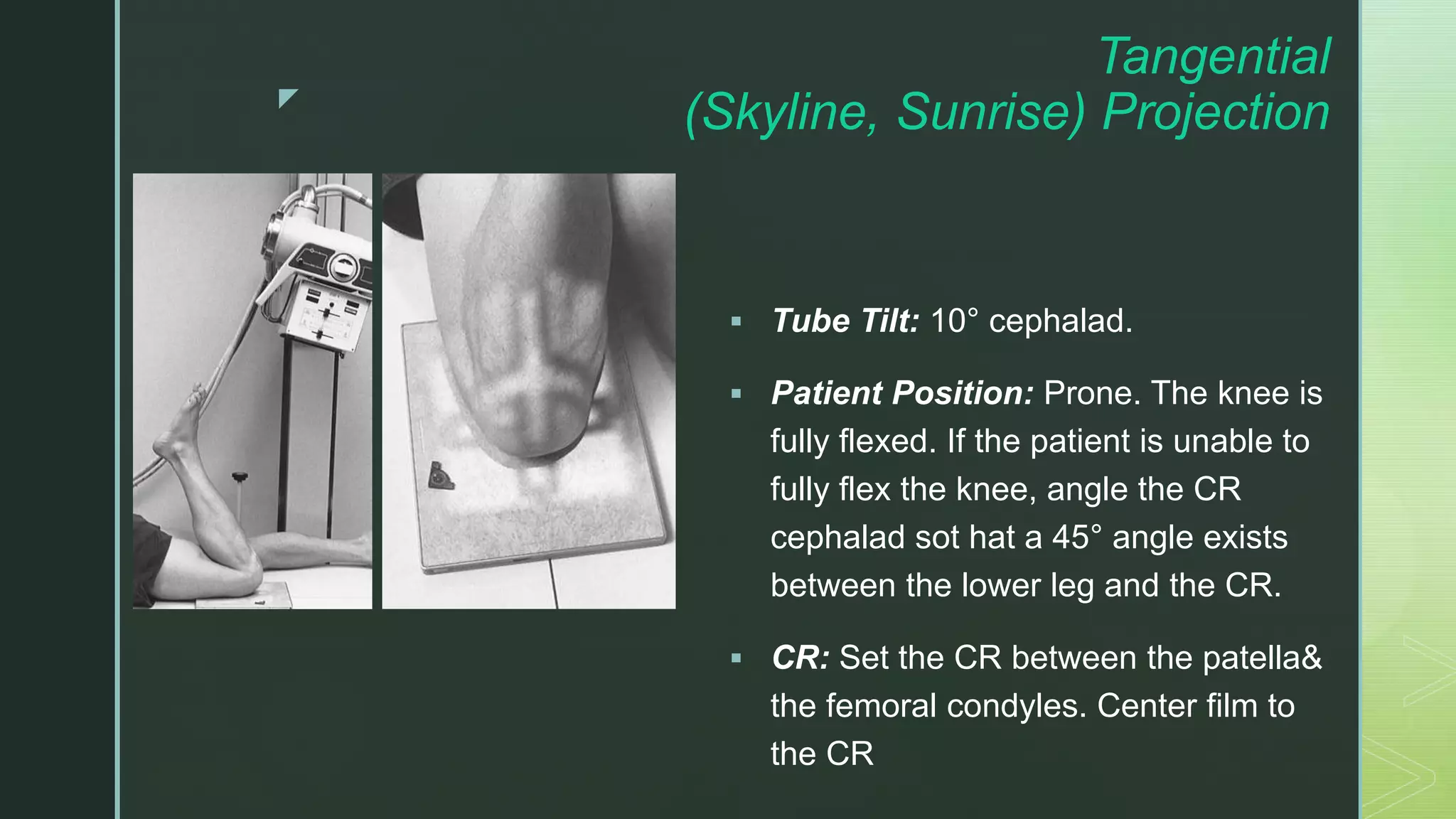 X ray knee joint | PPTX