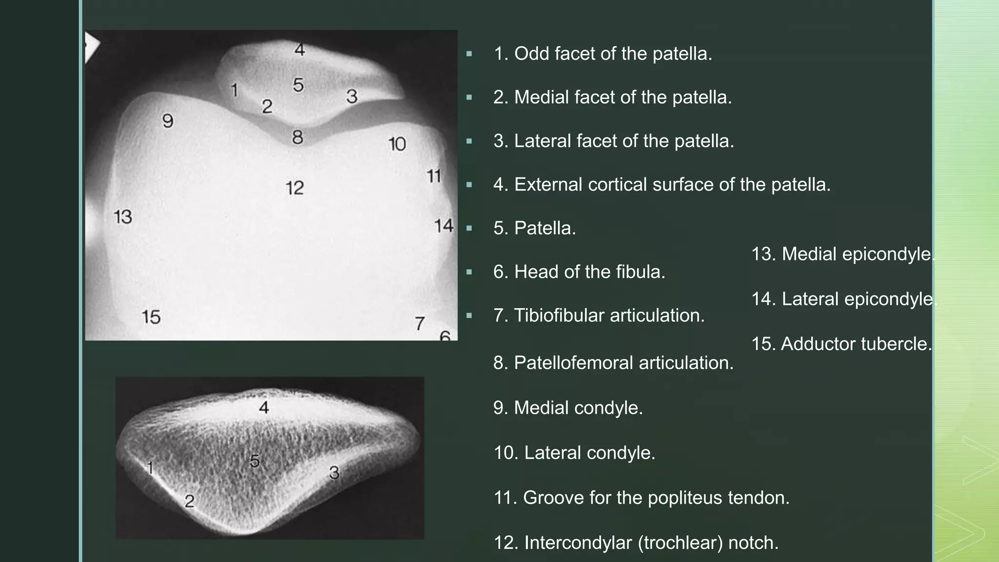 X ray knee joint | PPTX