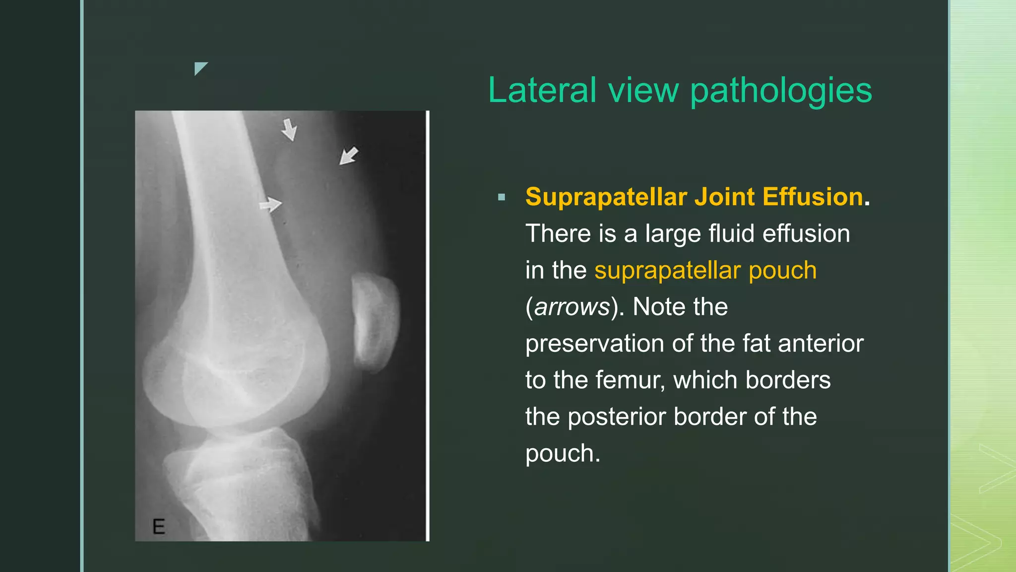 X ray knee joint | PPTX