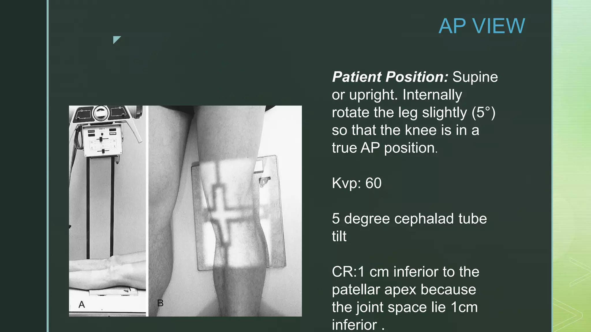 X ray knee joint | PPTX
