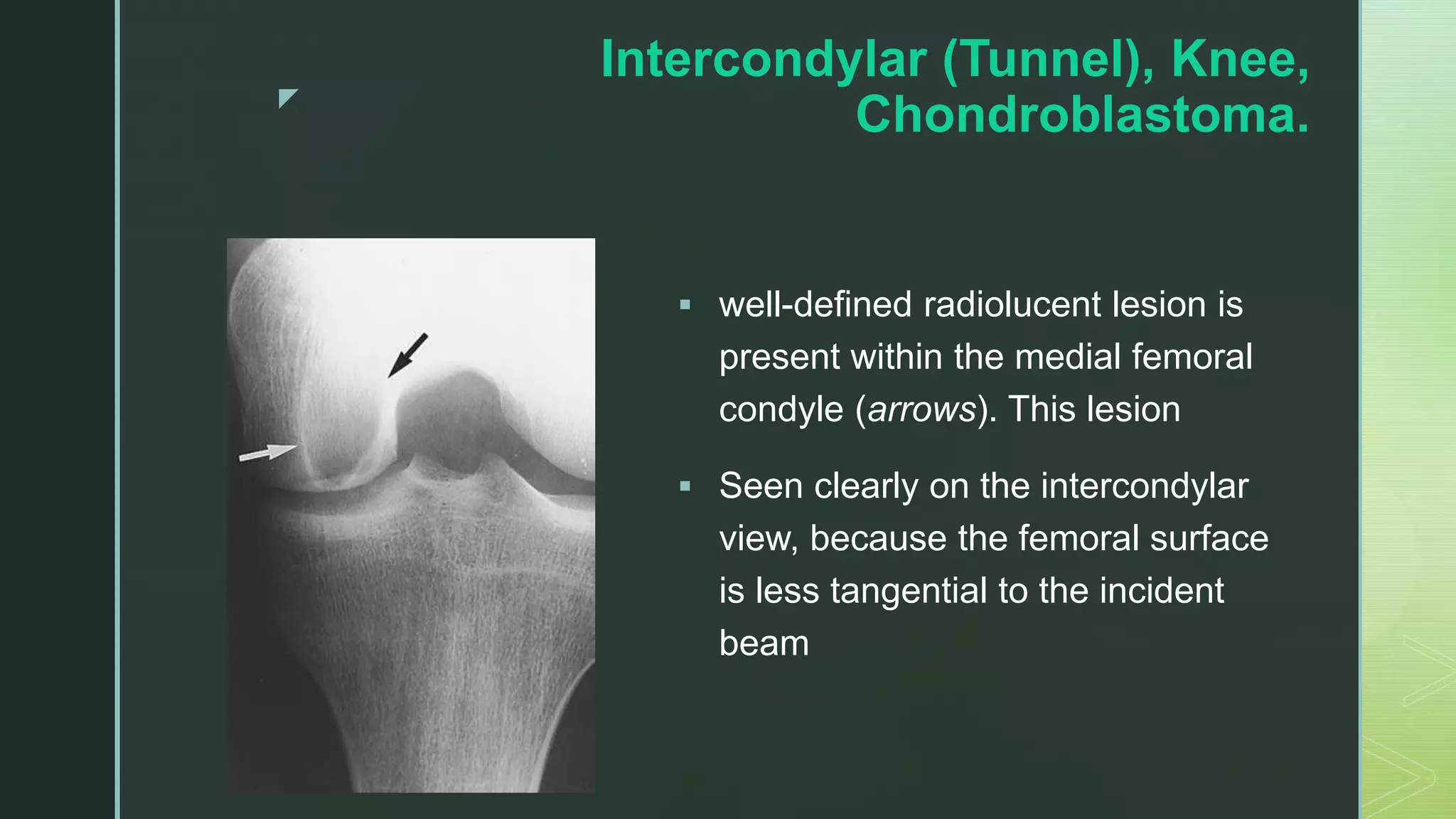 X ray knee joint | PPTX