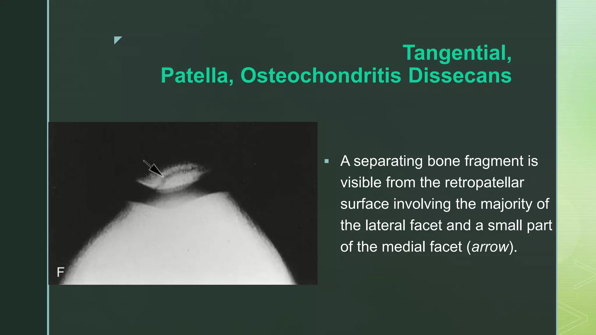 X ray knee joint | PPTX