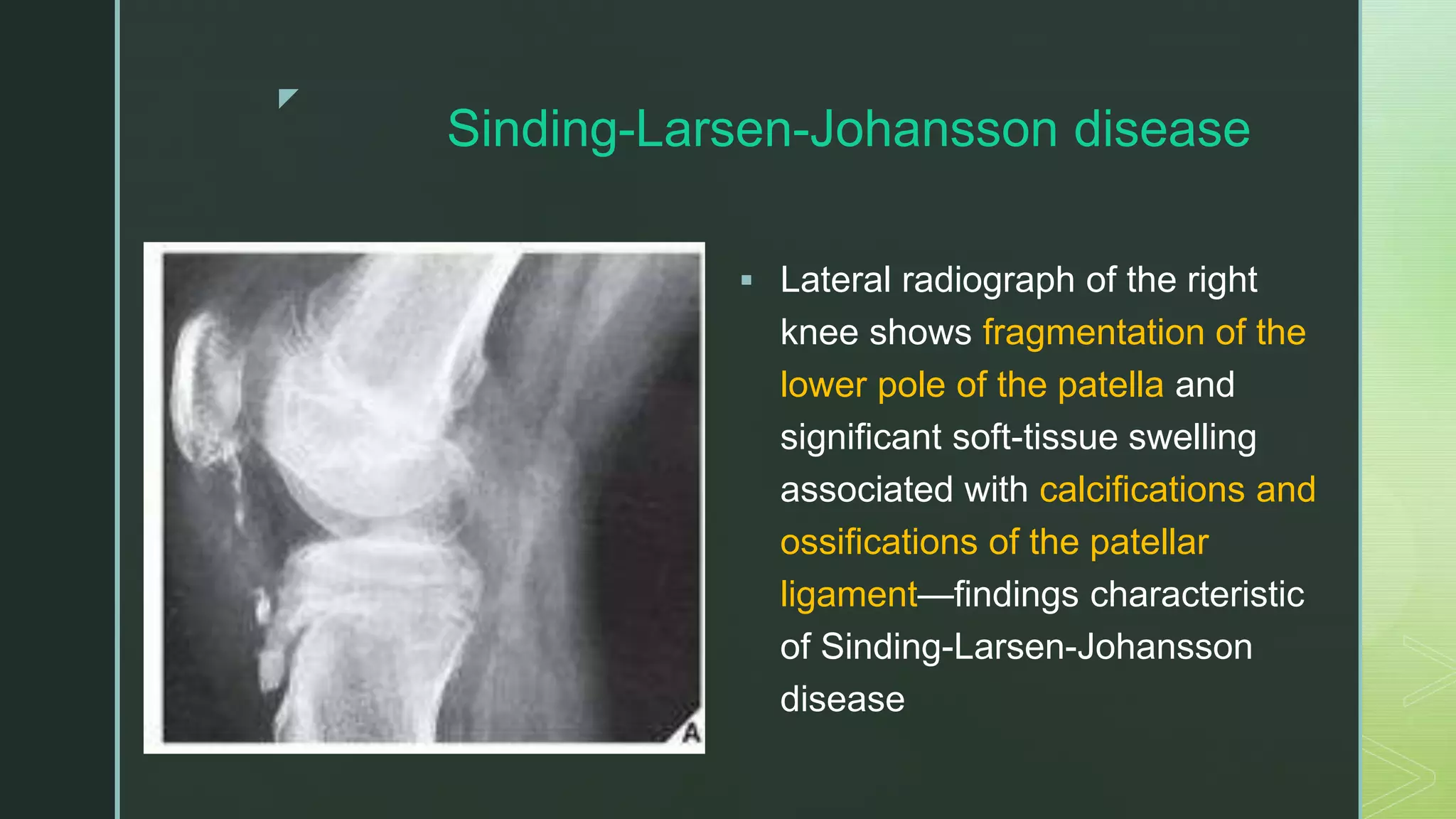 X ray knee joint | PPTX